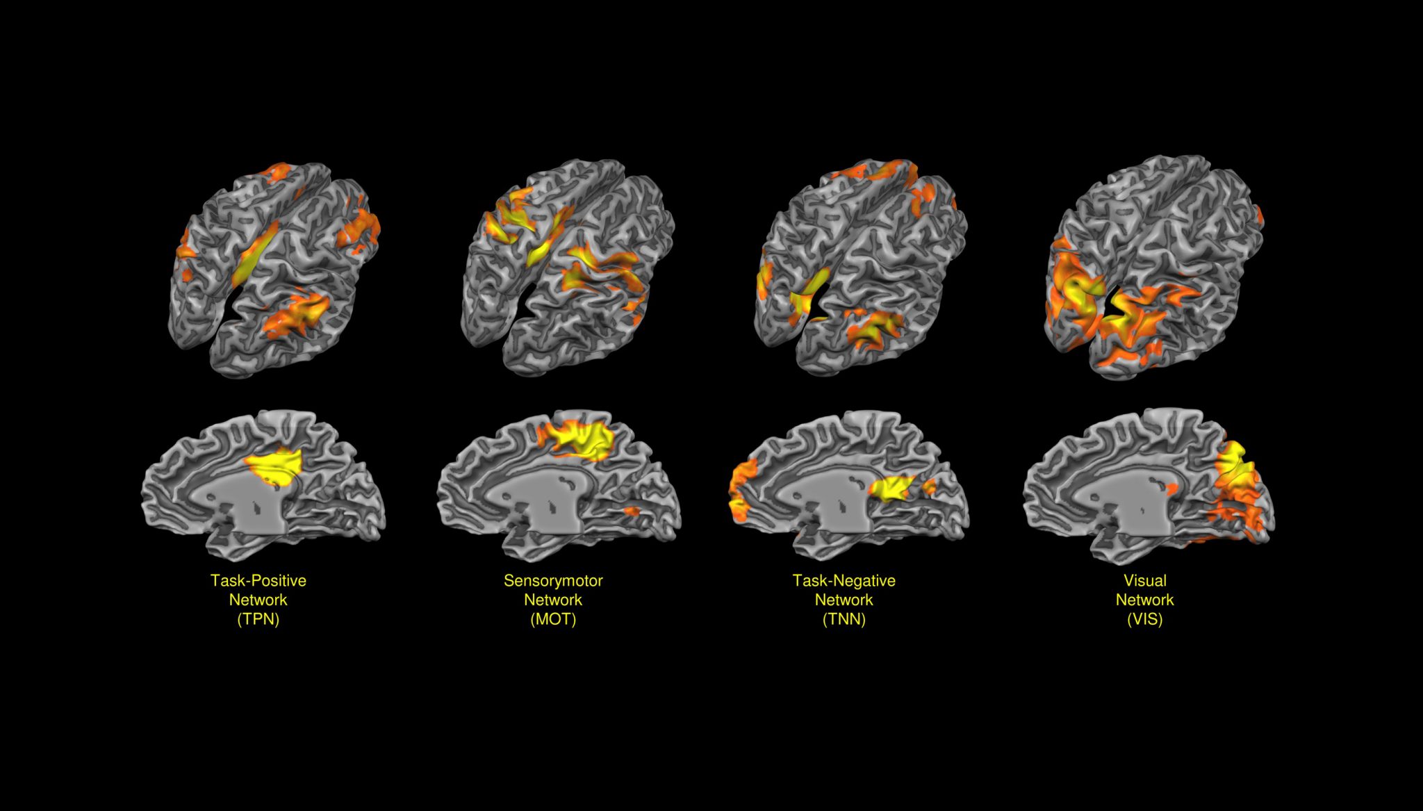 The Hard Problem of Consciousness: A Cognition Problem? – Nick Byrd, Ph.D.